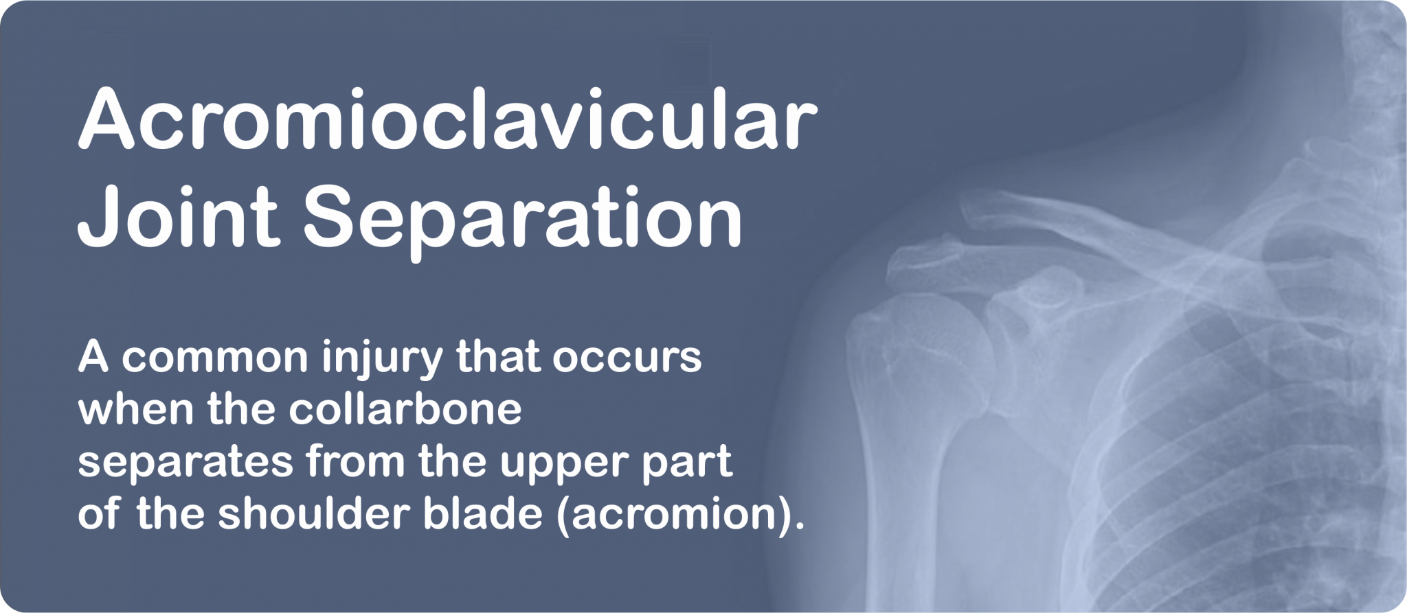 Acromioclavicular Joint Separation - General Practitioners Ringwood ...