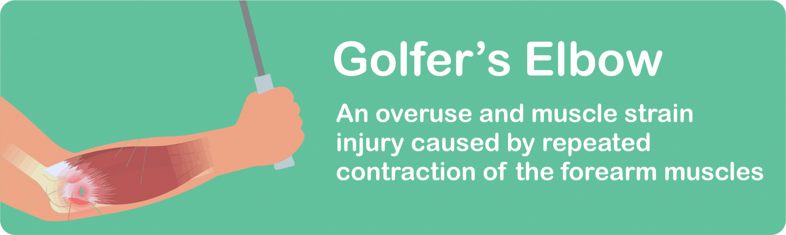 Golfer's Elbow (Medial Epicondylitis) - General Practitioners Ringwood ...