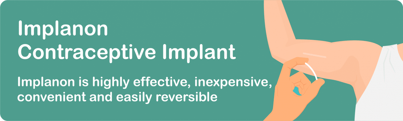 Implanon contraceptive implant - General Practitioners Ringwood ...